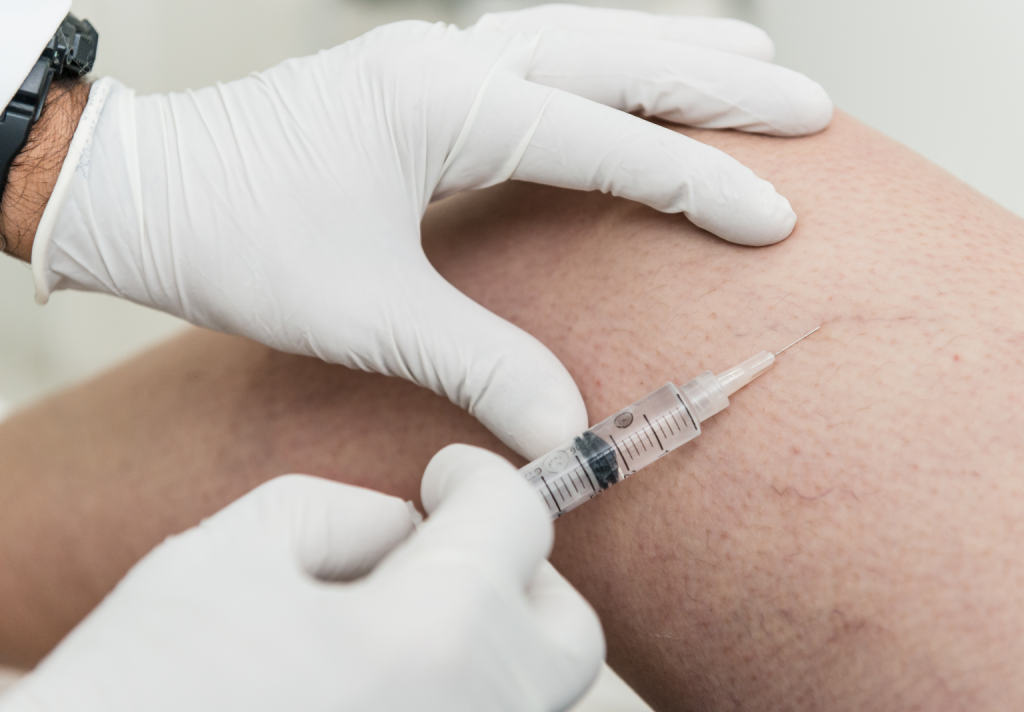 What is Sclerotherapy? - Azure Medical